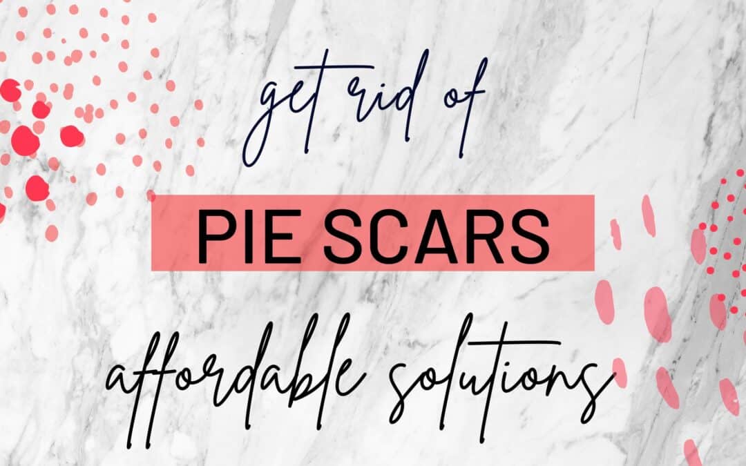 PIE Scars Archives - Hello Mia Wilson